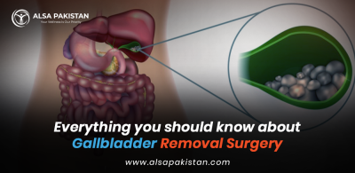 Everything you should know about Gallbladder removal surgery