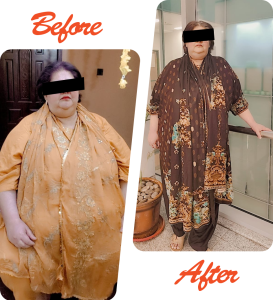 Alsa Pakistan- An ultimate destination for weight loss experts