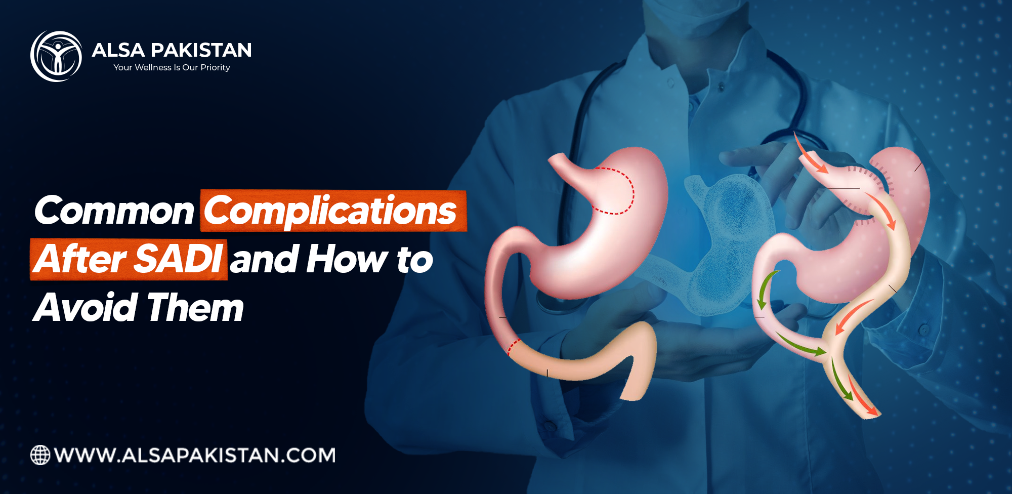 Common Complications After SADI and How to Avoid Them