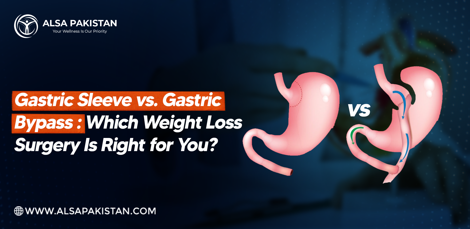 Gastric sleeve vs gastric bypass: Which weight loss surgery is right ...